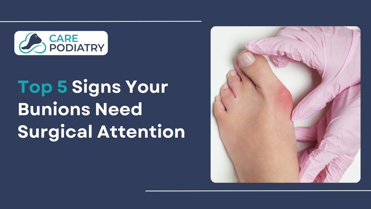 Top 5 Signs Your Bunions Need Surgical Attention